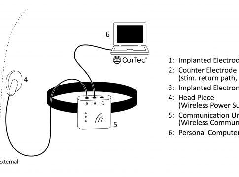 Martin Schuettler - CorTec GmbH | Open Access Government